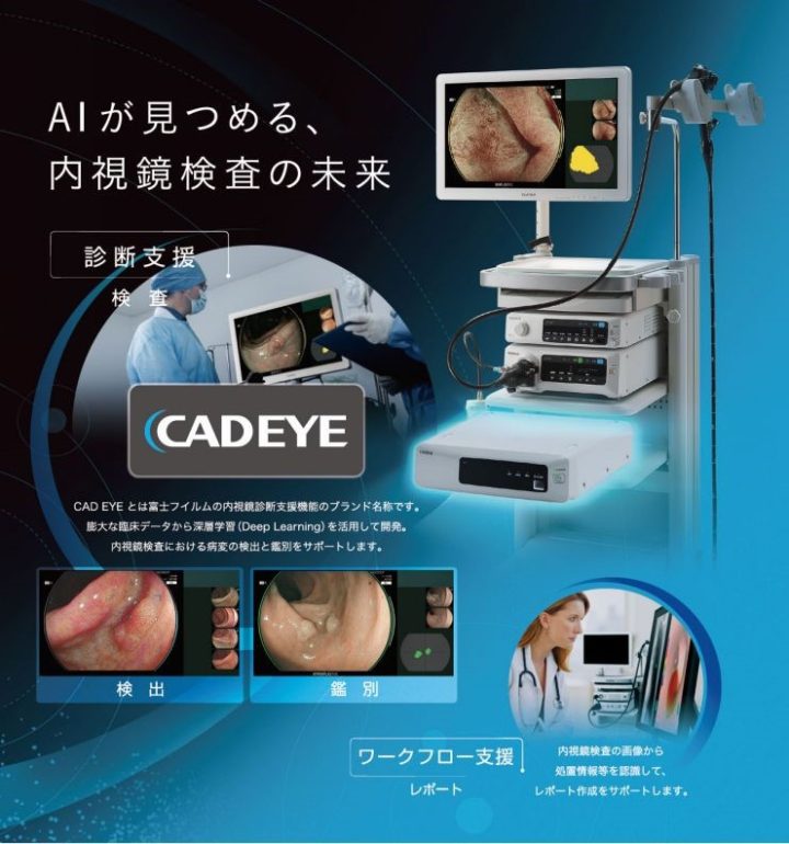 内視鏡診断支援機能「CADEYE™」｜仙台薬師堂いしばし消化器内視鏡クリニック｜仙台若林区